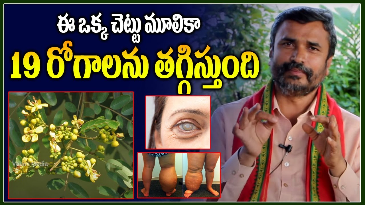 ఈ చెట్టు మూలికా 19 రోగాలను శాశ్వతంగా తగ్గిస్తుంది || Sonamukhi tree ...