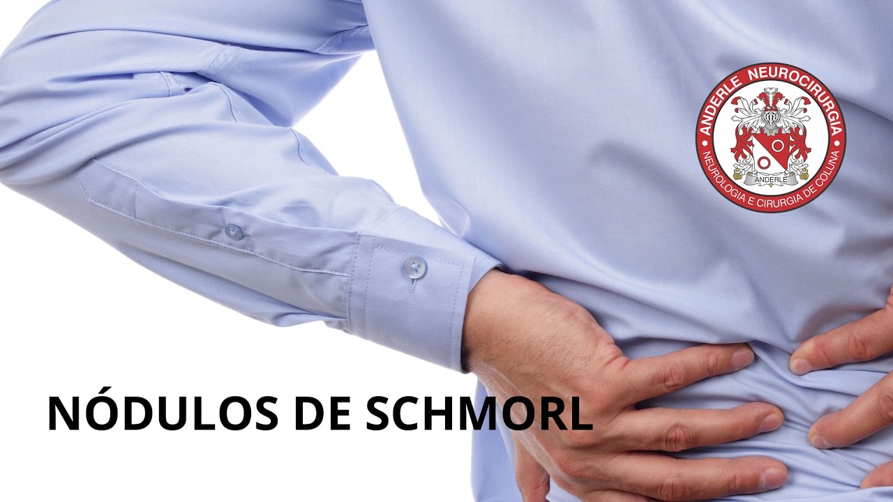 Nódulos de SCHMORL Dr Diogo - YouTube