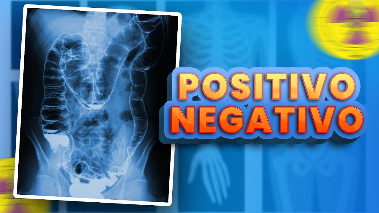 CONTRASTE POSITIVO VS CONTRASTE NEGATIVO NA RADIOLOGIA - YouTube