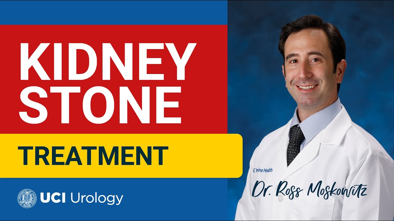 Kidney Stone Treatment By Dr. Ross Moskowitz - UC Irvine Department of ...