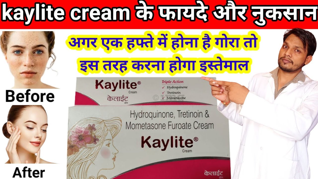 kaylite cream || Kaylite cream ke fayde || kaylite cream kaise use ...