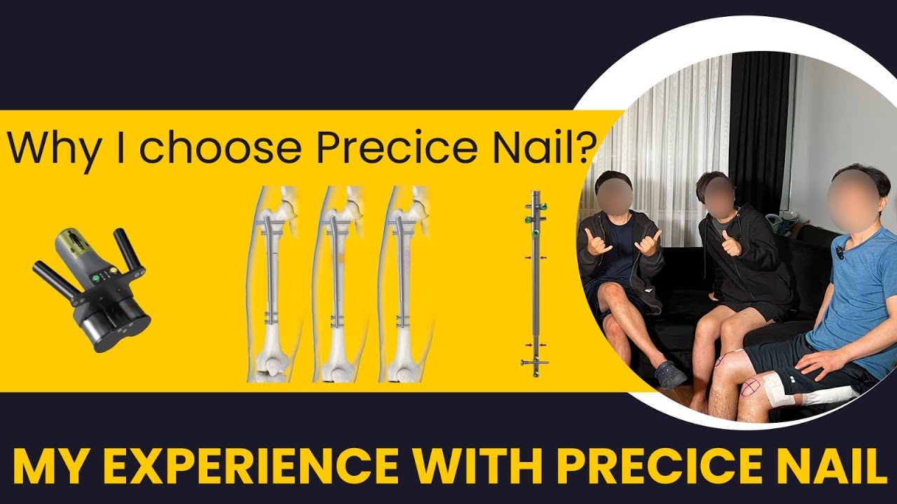 Why I choose Precice 2 method? My experience with Precice Nail - YouTube