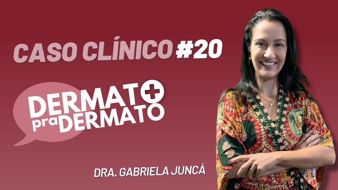 Dermato pra Dermato #20 - Caso Clínico - YouTube