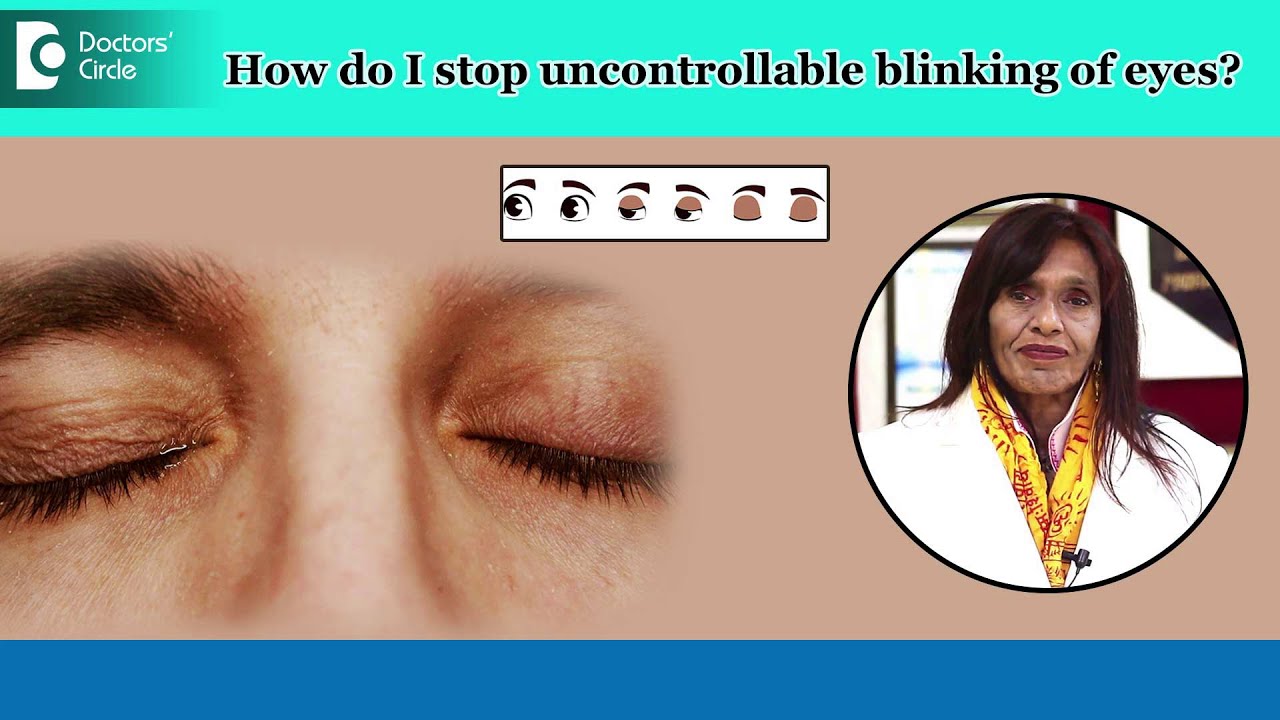Causes of Continuous EYE Blinking| How to STOP Eye Twitching?-Dr.Sunita ...