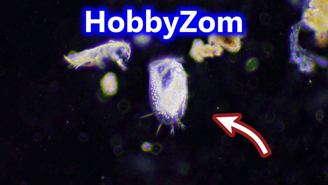 Microscopic Ciliate poses for a PHOTO SHOOT - YouTube