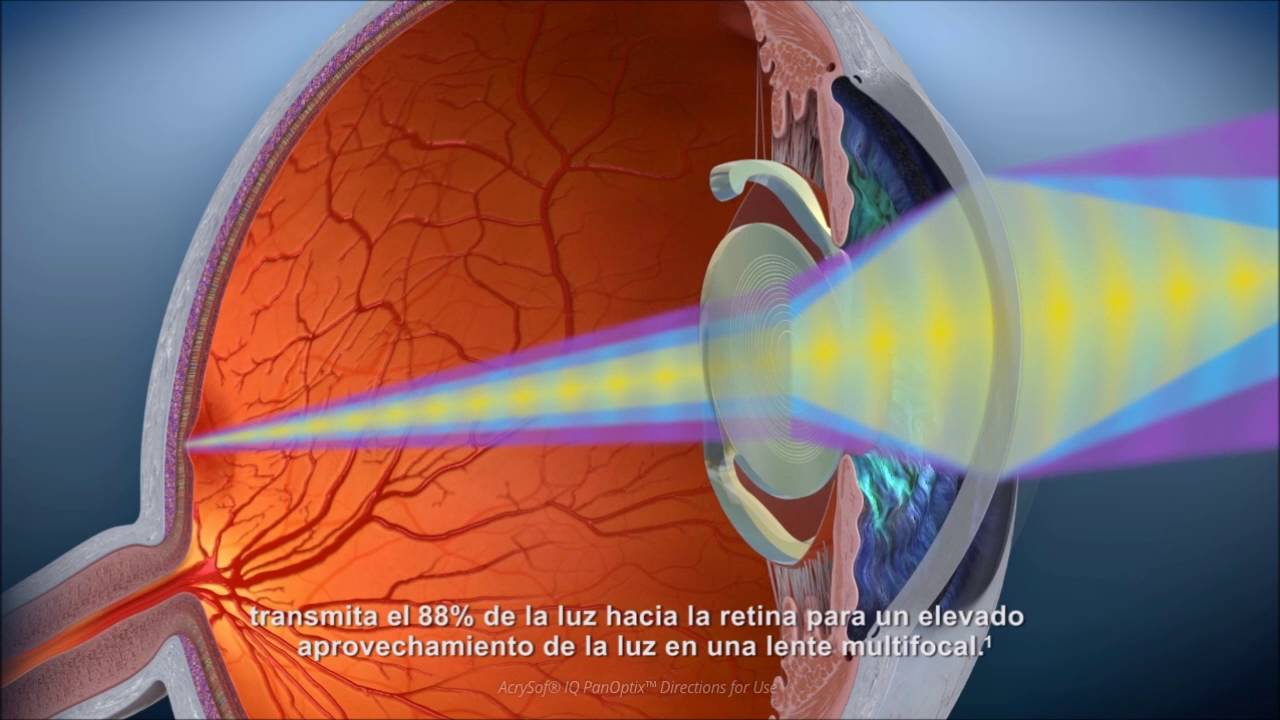 Lentes Trifocales Para La Corrección De Vista Cansada Youtube