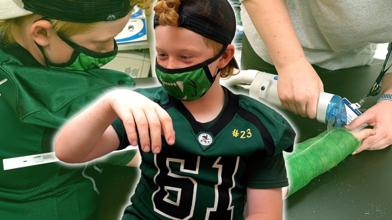 HIS BROKEN ARM IS FINALLY HEALED AND THE CAST IS OFF! - YouTube