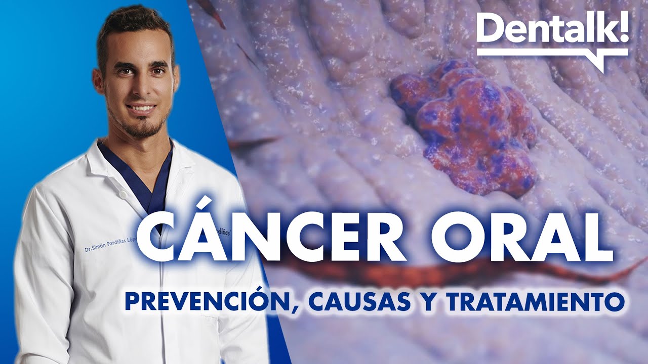 CÁNCER en la BOCA - Síntomas, prevención y tratamiento del cáncer de ...
