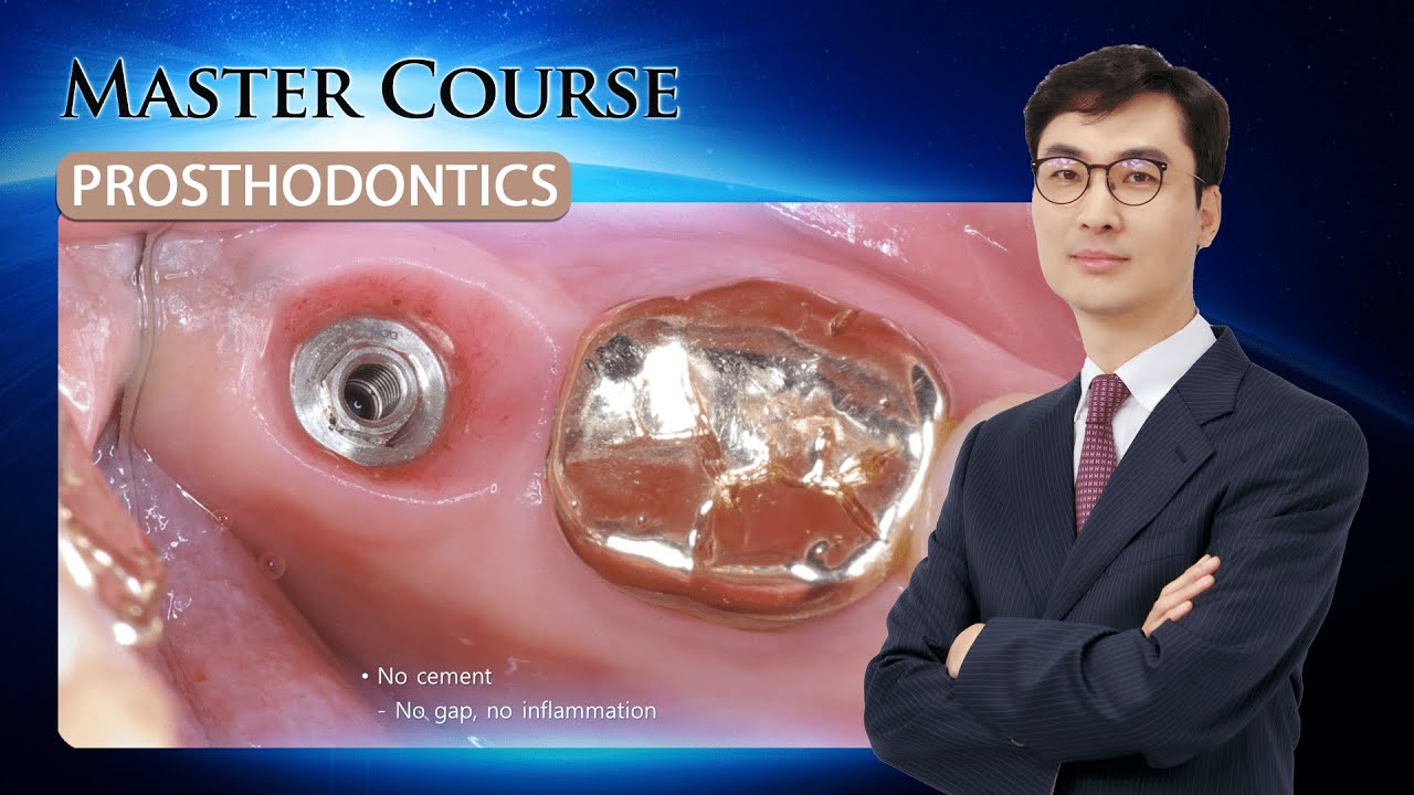 [Master Course - PROSTHODONTICS] Prosthodontic type of osstem implant ...