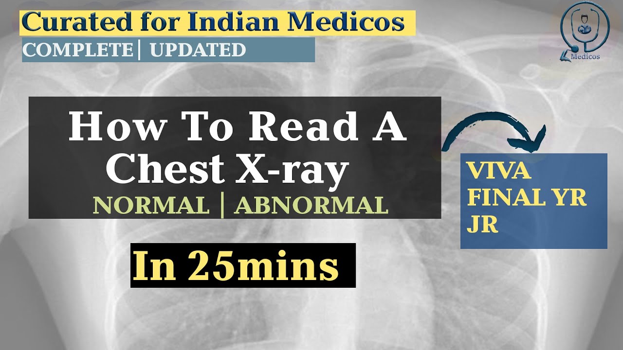 How to Report Chest X-ray | Normal & Abnormal Chest X-ray ...