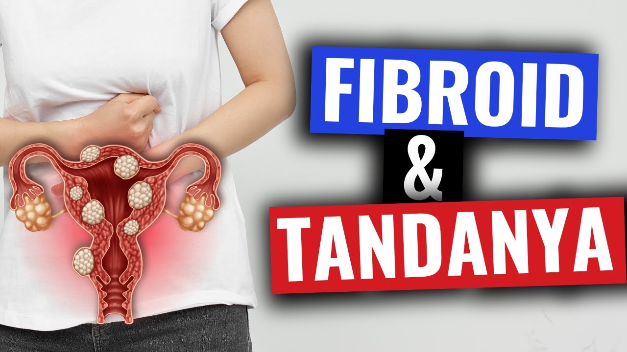 Apa Itu Fibroid Dan Tanda Tanda Anda Menghidapnya. Cepat Periksa! - YouTube