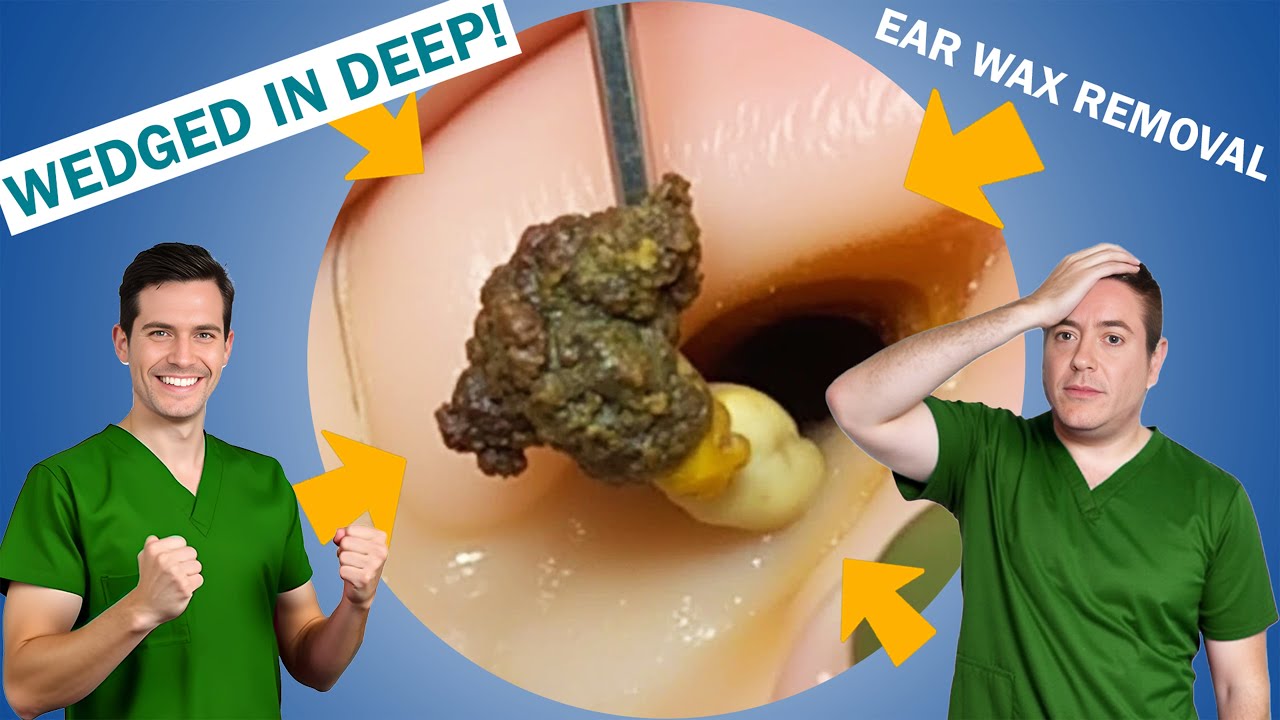 ASMR Ear "Insanely Satisfying Deep Ear Cleaning ASMR" | Cotton Bud ...