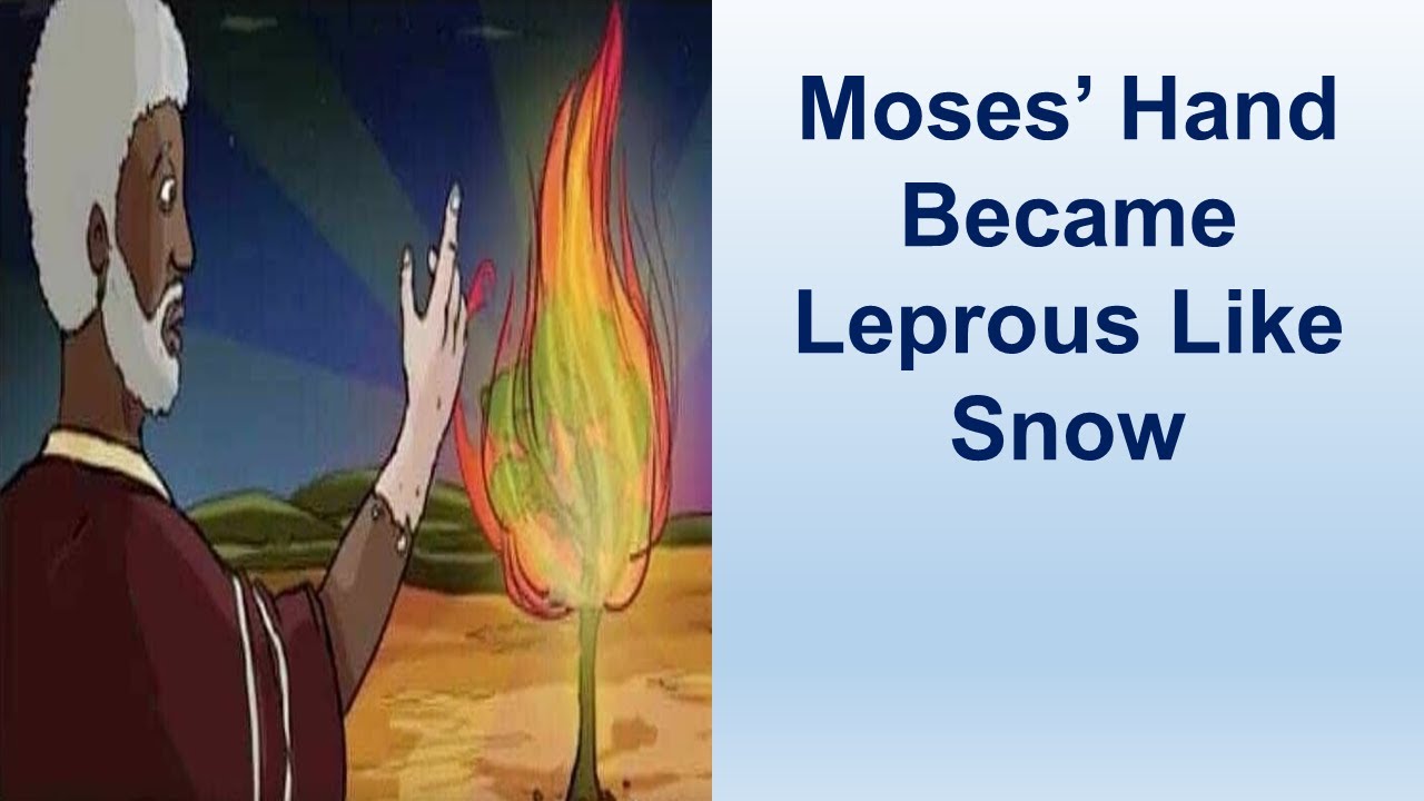 Moses' Hand Became Leprous Like Snow - Exodus 4:1-31 - YouTube