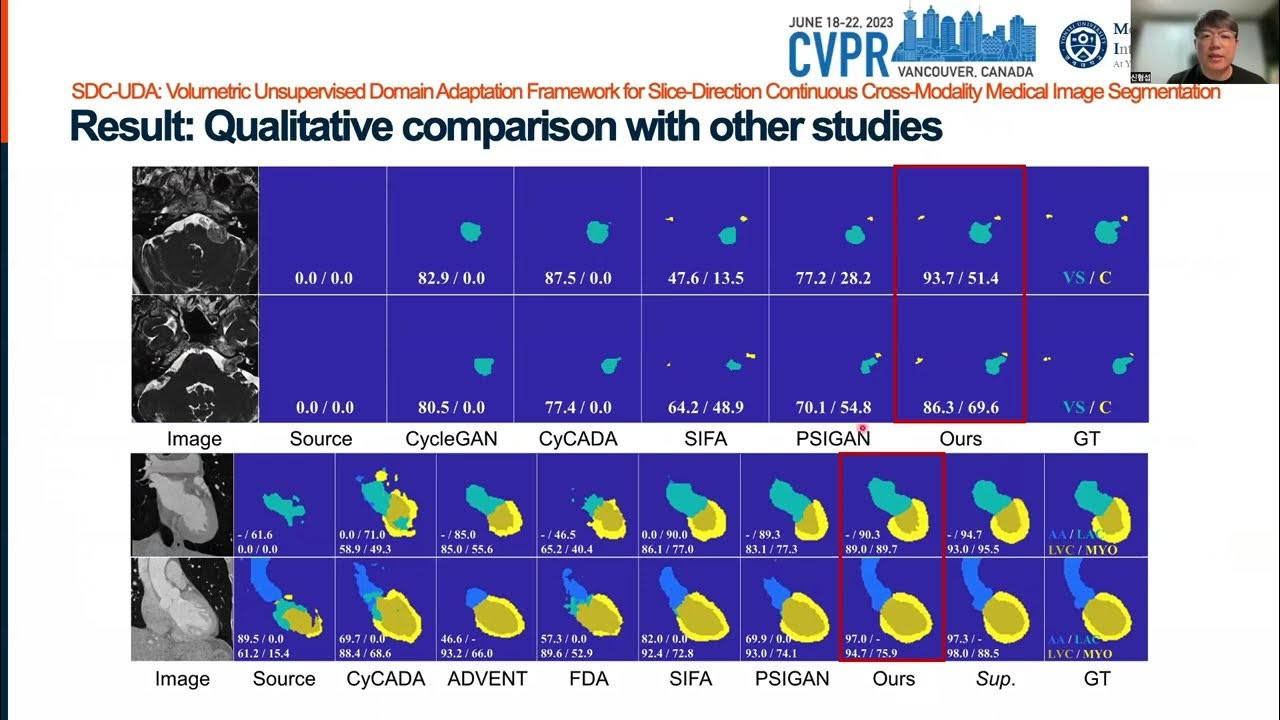 [CVPR 2023] SDC-UDA (8-Min Presentation Video) - YouTube