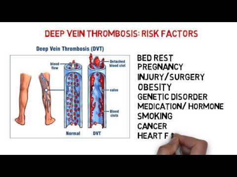Deep vein thrombosis (DVT) - Risk factors - YouTube