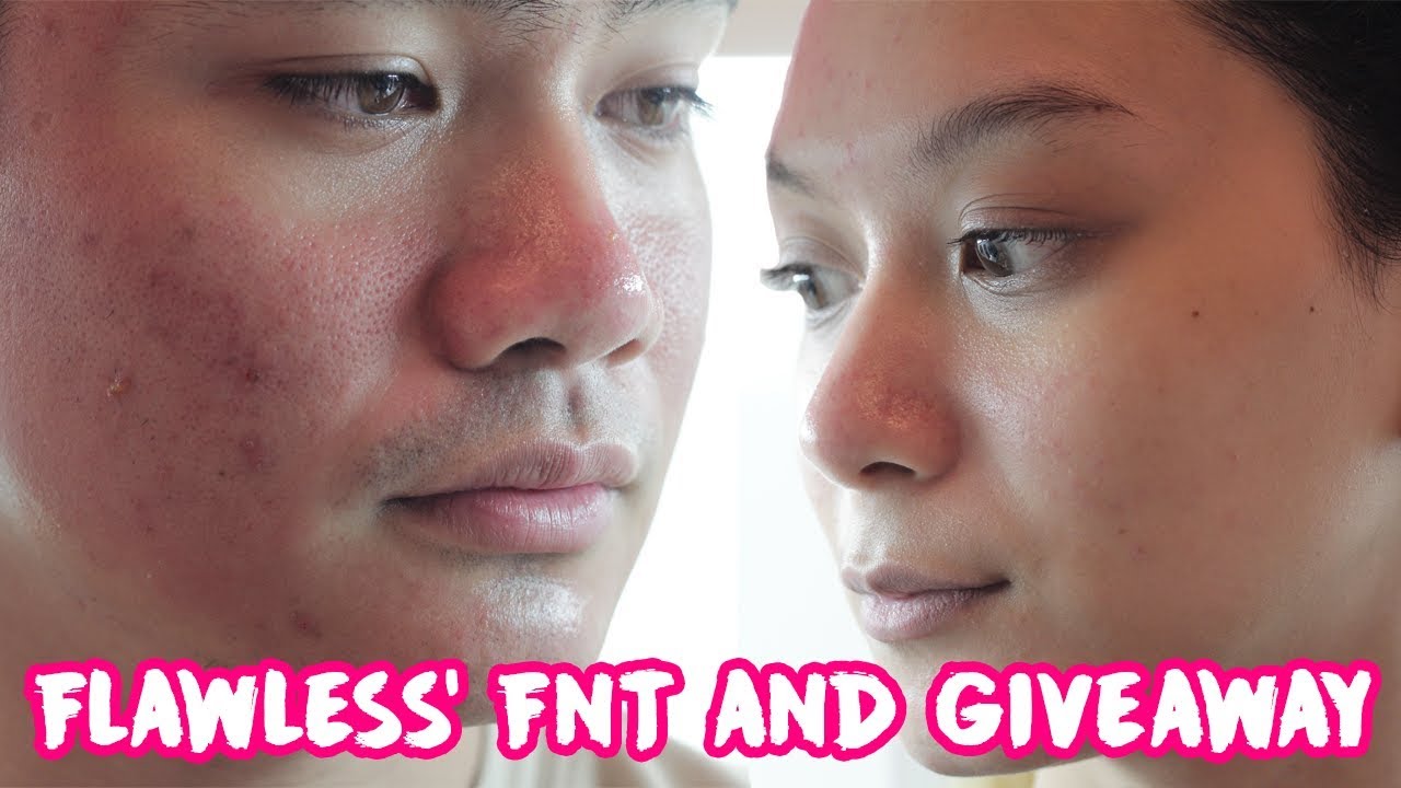 FLAWLESS FRACTIONAL NEEDLING THERAPY + GIVEAWAY | WE DUET - YouTube
