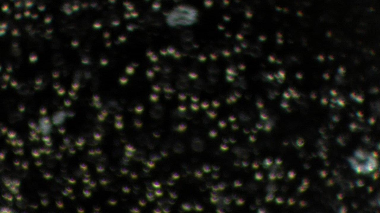 12-4-16 Blood under Dark Field Microscopy - YouTube