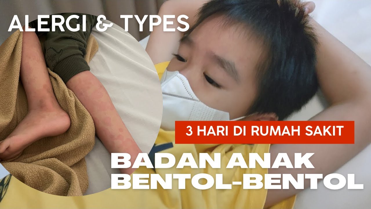 Awai Masuk RS lagi| ‼️ Badan Bentol-Bentol Sakit Alergi & Types # ...