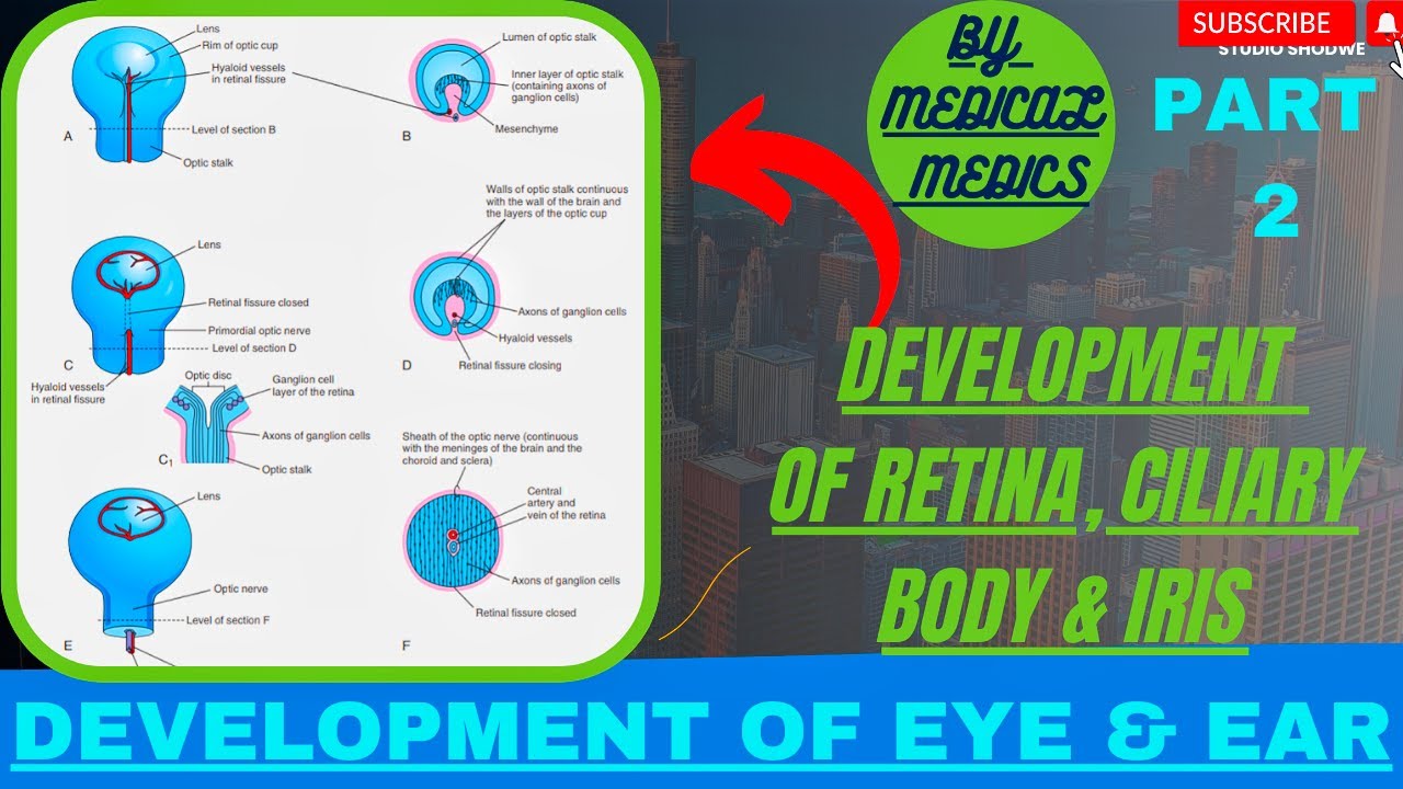 Development of Retina , Ciliary Body & Iris | Eye Embryology | Medical ...