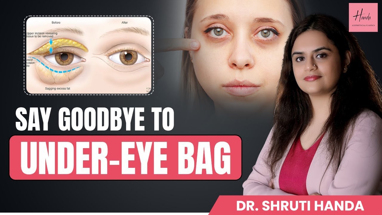 Lower Eyelid Fat Removal | Transform Your Look with Blepharoplasty | Dr ...