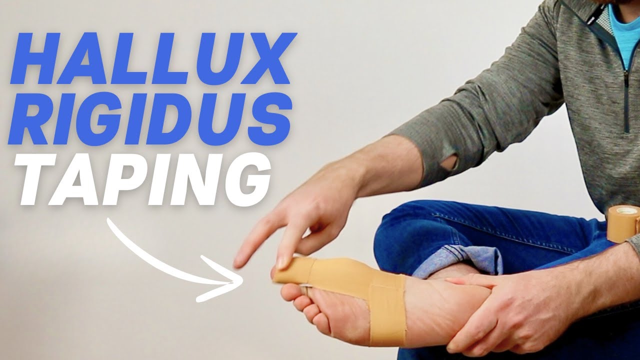 Hallux Rigidus Taping | Big Toe Arthritis Taping - YouTube