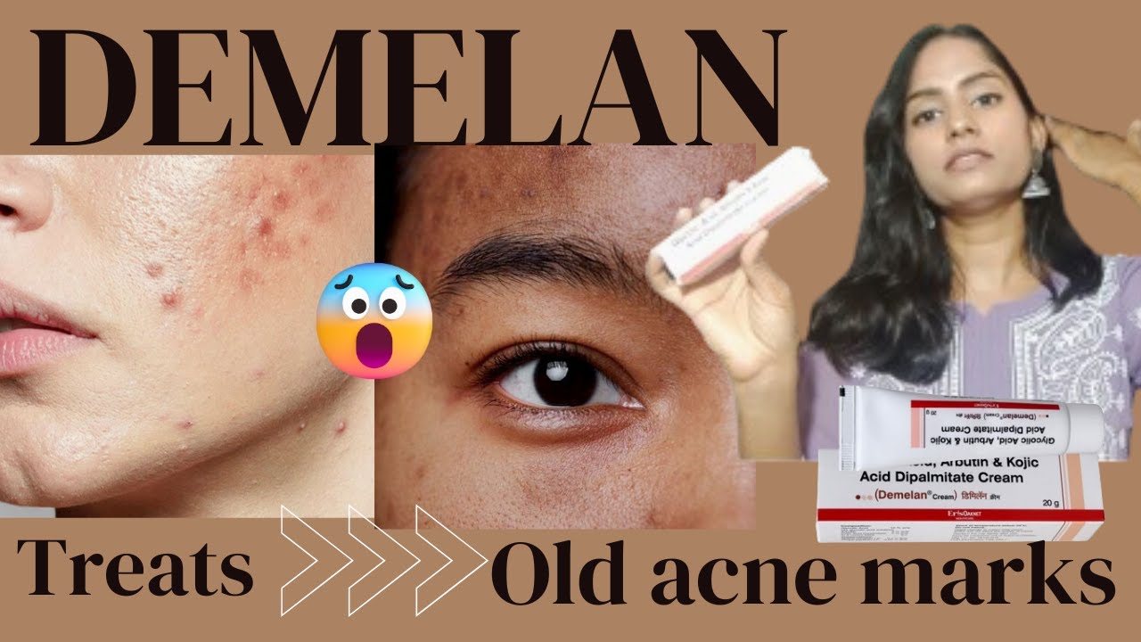 The😱Ultimate Guide to use DEMELAN Cream | #demelancream #video #viral # ...