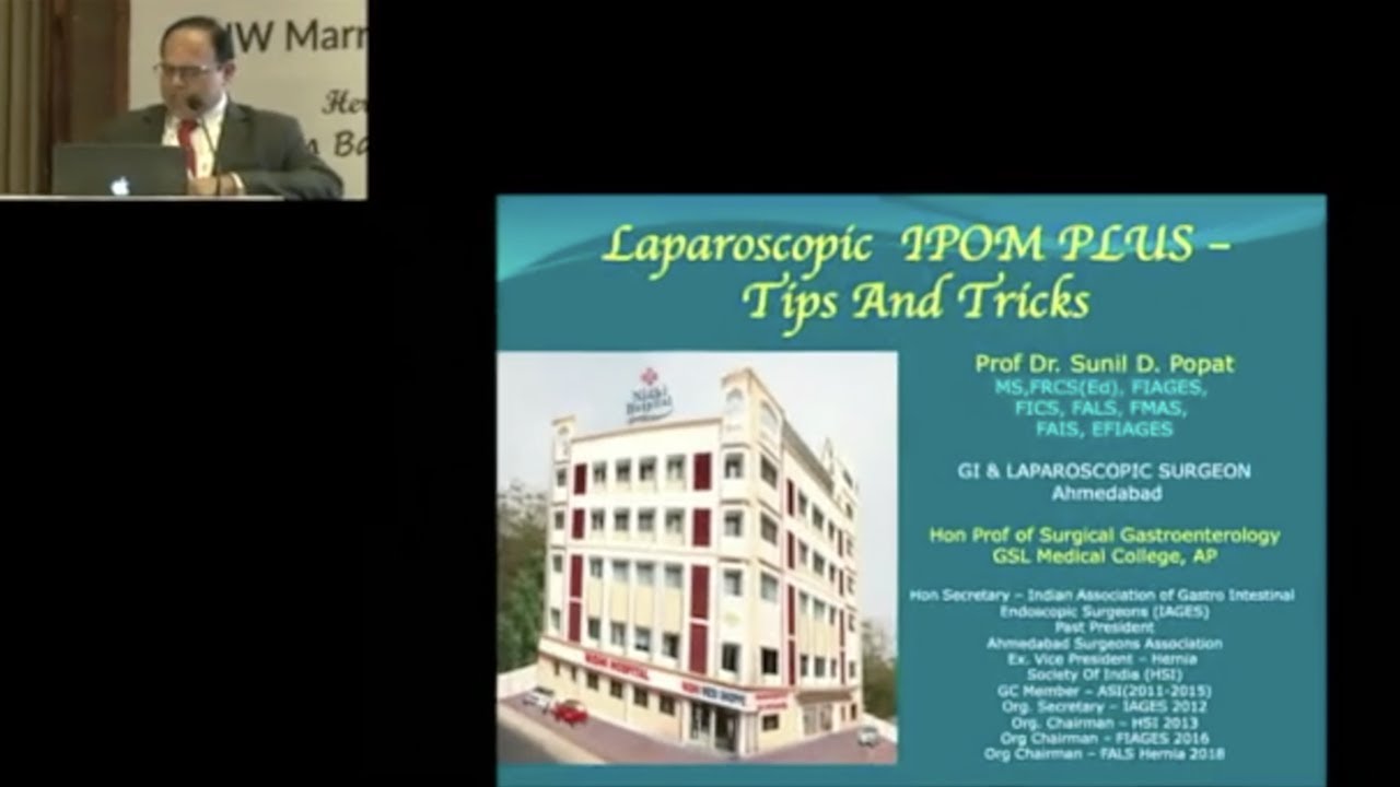 IPOM plus tips and tricks - YouTube