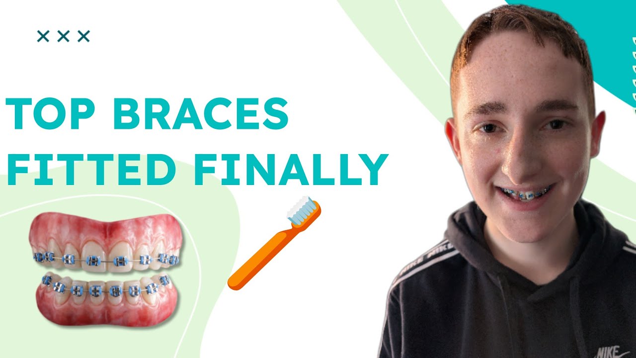 TOP BRACES FITTED AT LAST!! - YouTube