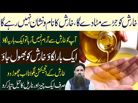 kharish khatam karne ka tarika | kharish Ka ilaj | kharish ka asan ilaj | Dr Sharafat Ali New Video