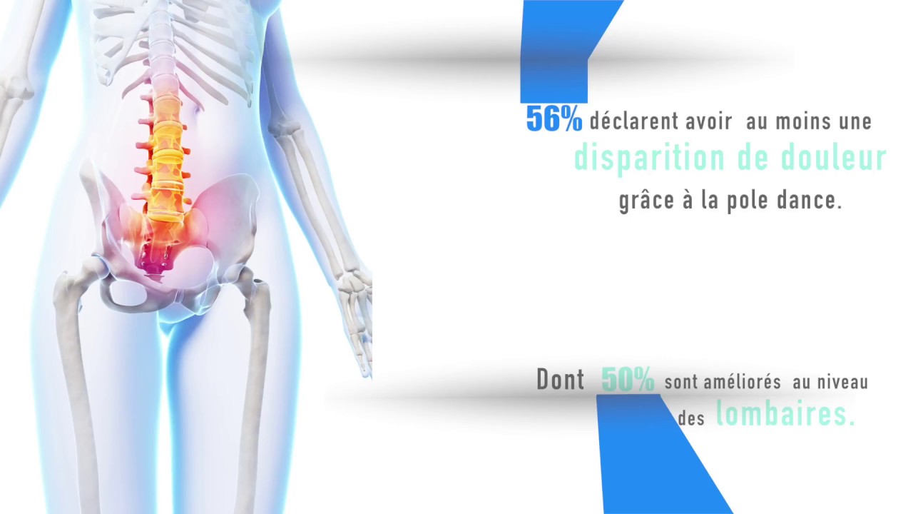 Prevalence des blessures en Pole dance 2017 #Pole dance physio - YouTube