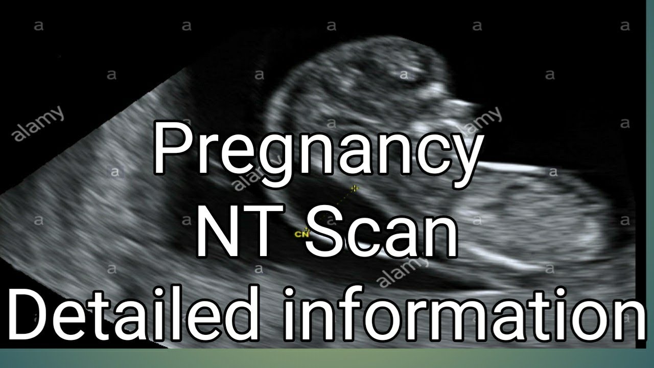 NT Scan detailed information|NT Scan Benefits|NT Scan Measurements in ...