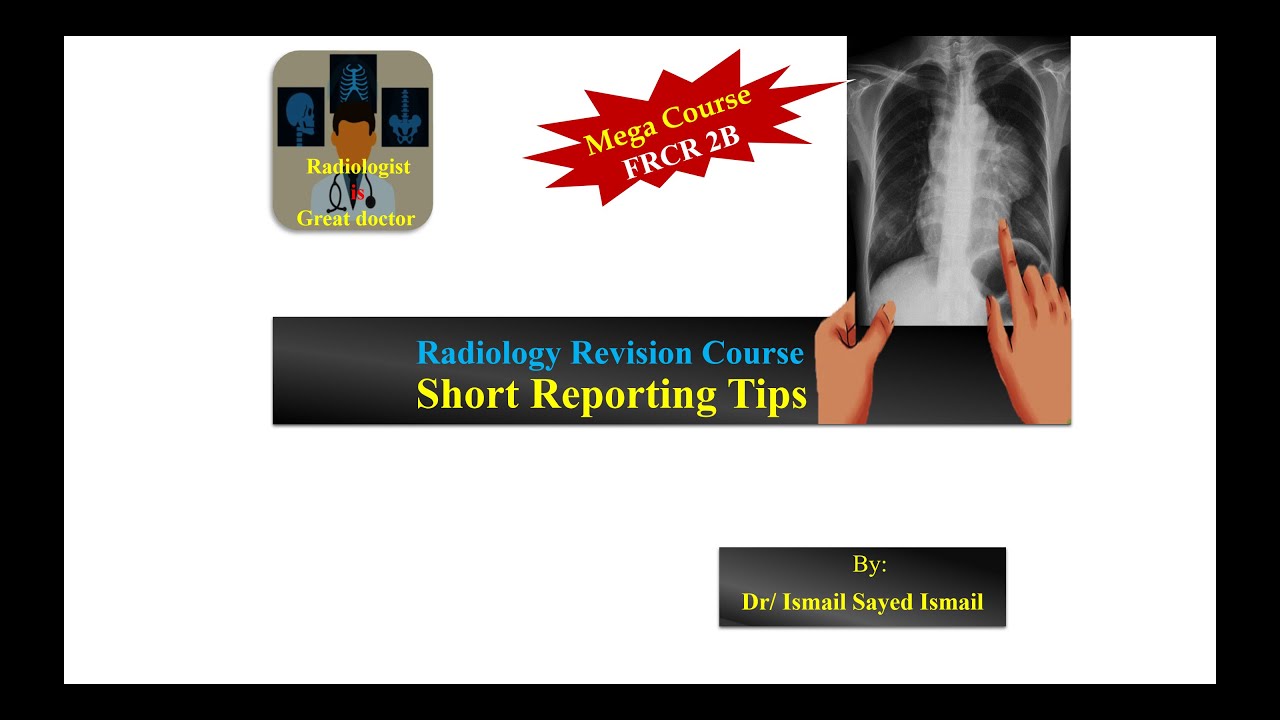 Short Reporting for FRCR 2B -Chest - YouTube