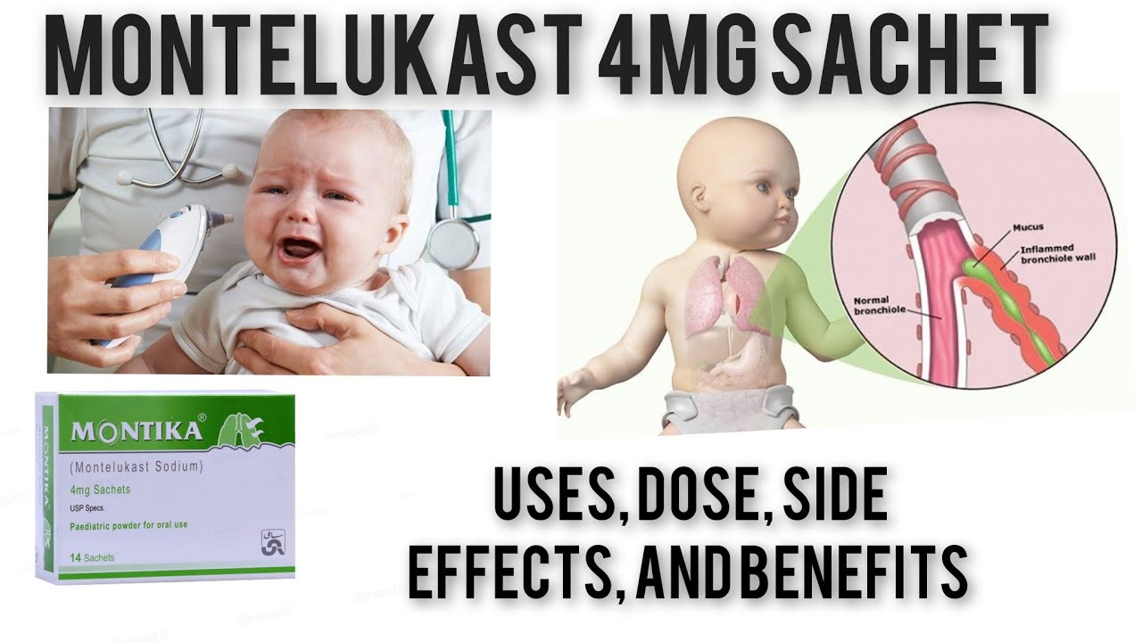 Montelukast 4mg sachet||best montelukast 4mg sachet||best uses, dose ...