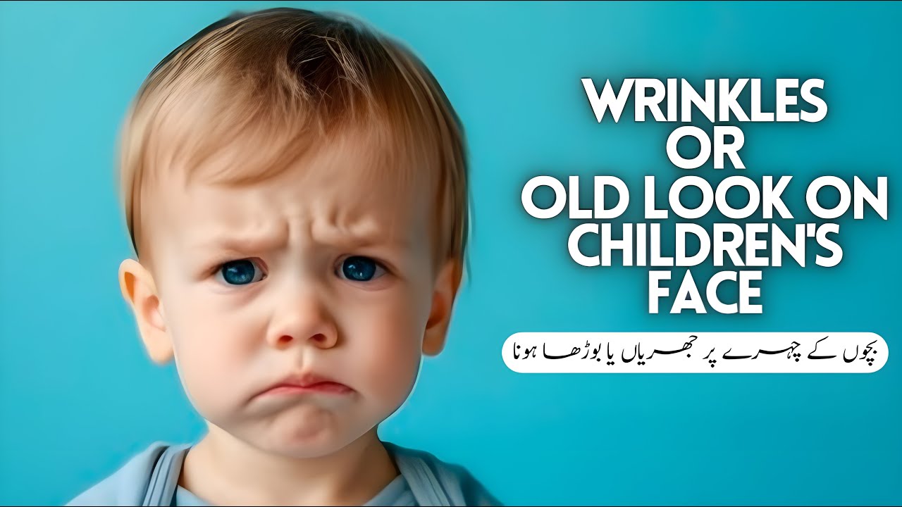 Wrinkles or Old Look on Children's Face | Homeopathic Medicine | By Dr ...