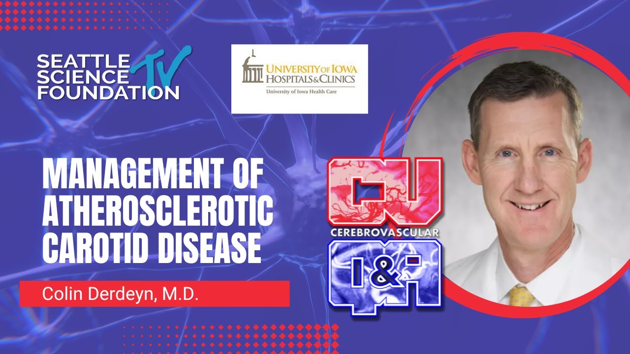 Management of Atherosclerotic Carotid Disease – Colin Derdeyn, MD - YouTube