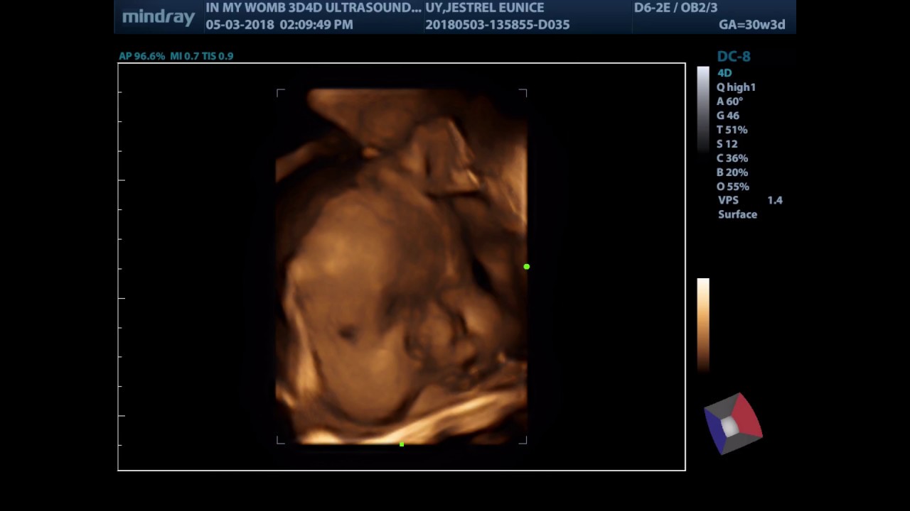30 and 31 Weeks 4D Ultrasound - YouTube