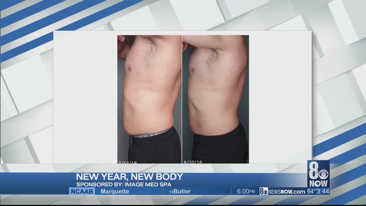 New year, new body at Image Med Spa - YouTube