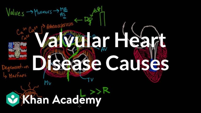 Valvular Diseases Of The Left Heart Youtube Valvular Heart Diseases