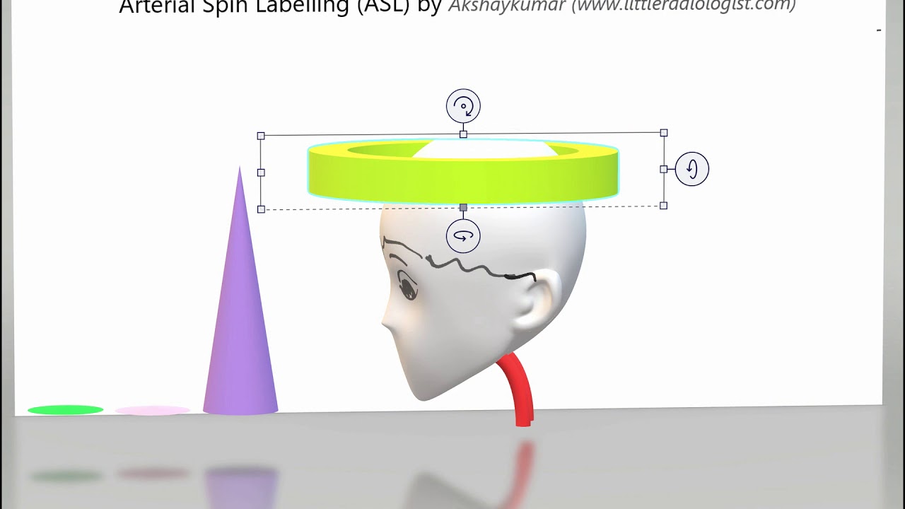 Arterial Spin Labeling (ASL): Music In MRI - YouTube