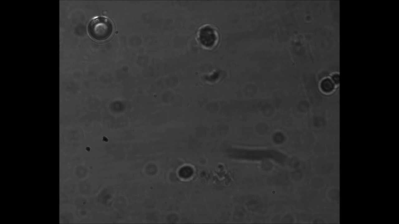 Optical Vortex Tweezers for L= 0, 5, and 8 - YouTube