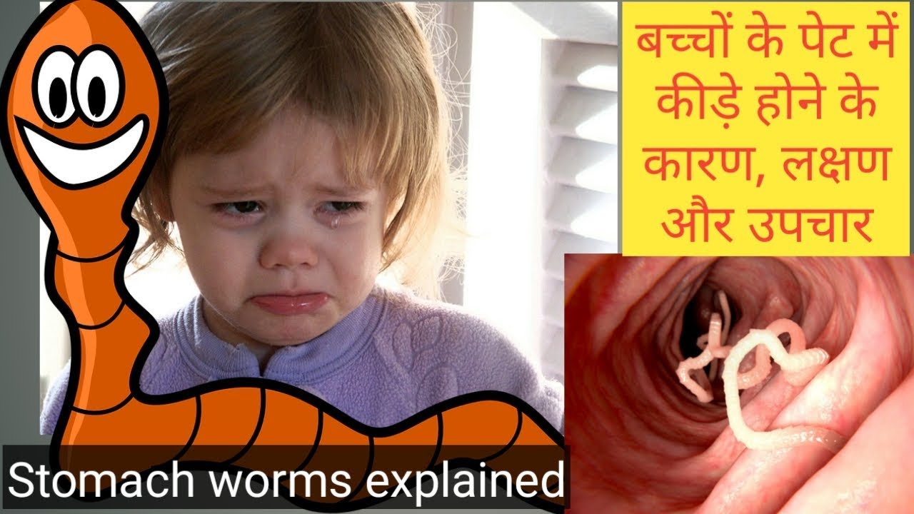 बच्चों के पेट में कीड़े होने के कारण ,लक्षण और उपचार|| Stomach worms ...