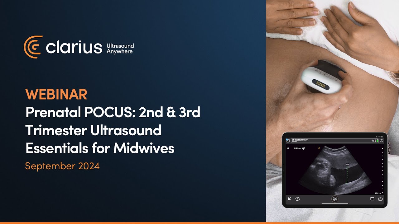 Prenatal POCUS 2nd & 3rd Trimester Ultrasound Essentials for Midwives ...