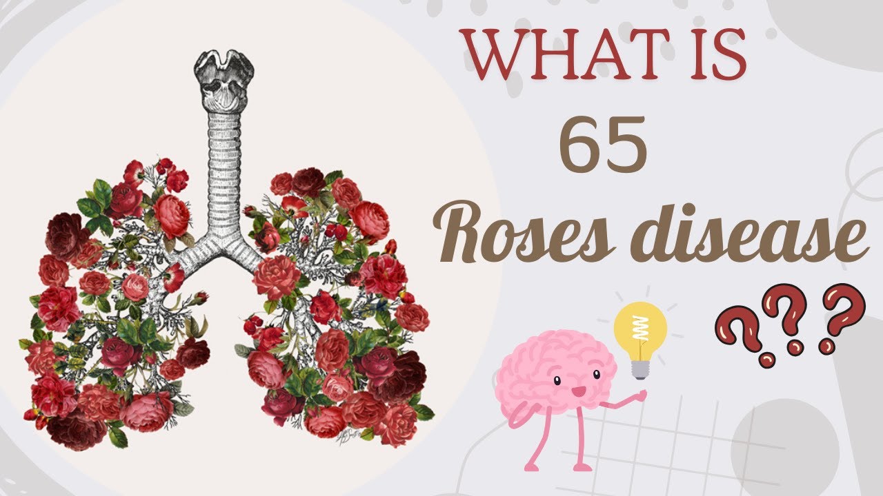 Welcome to MISS HELATH youtube channel / This is about 65 Roses or ...