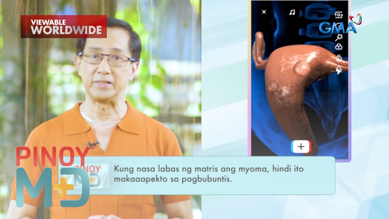 Babaeng may myoma sa matres, posible pa bang mabuntis? | Pinoy MD - YouTube
