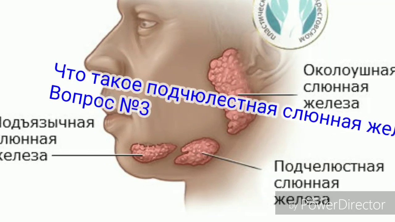 Подчелюстная слюнная железа Терапевтическая стоматология Вопросы на