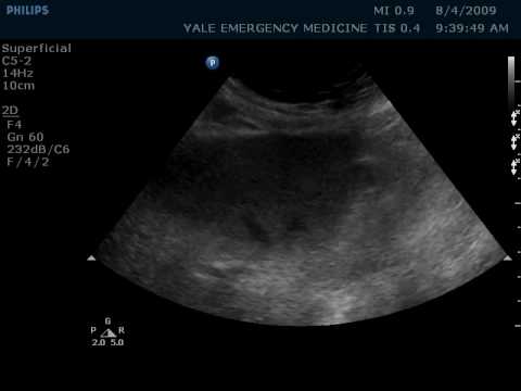 WES sign on superficial setting - YouTube