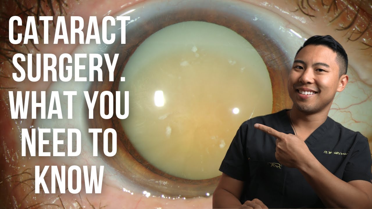 CATARACT SURGERY: Everything you need to know @MichaelRChuaMD - YouTube