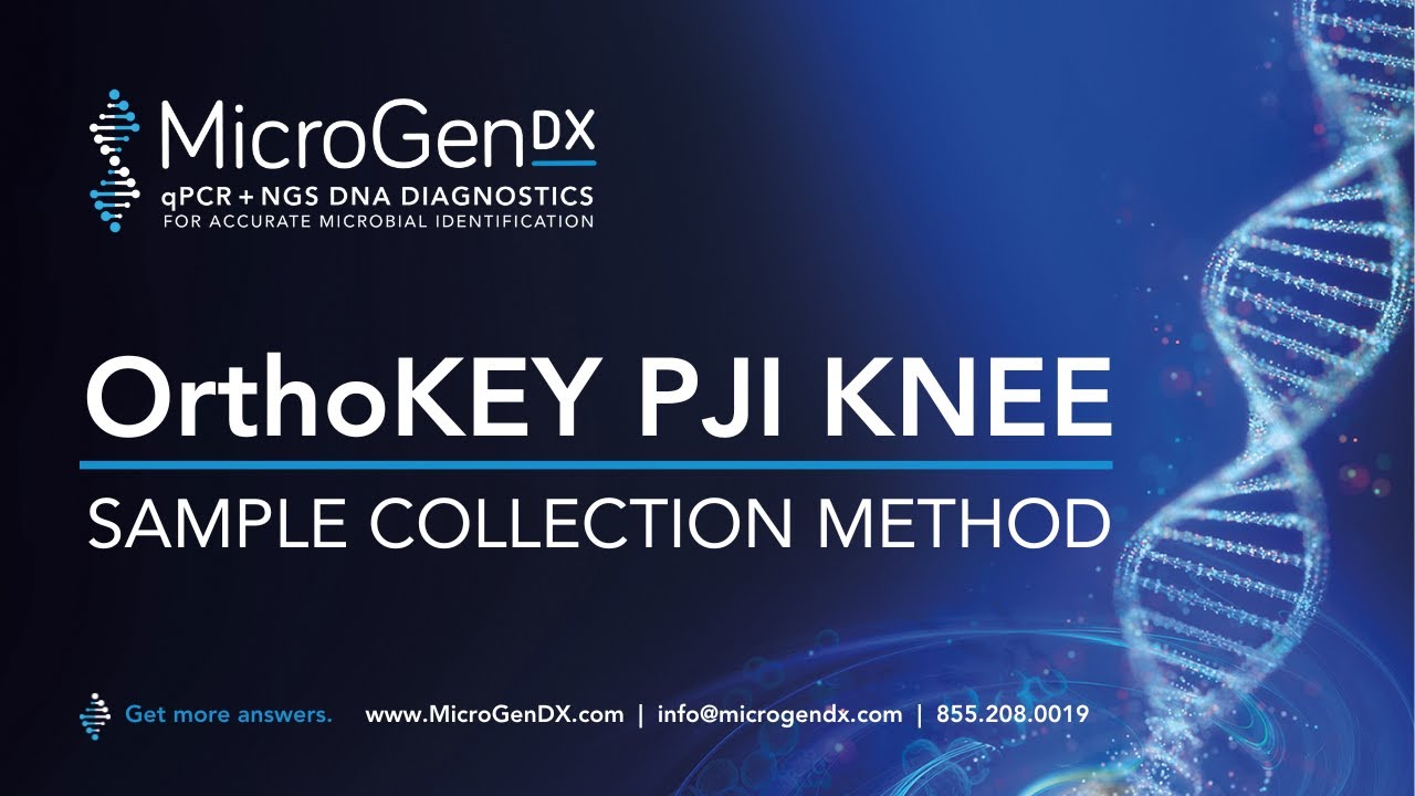 OrthoKEY PJI KNEE Sample Collection Method - YouTube