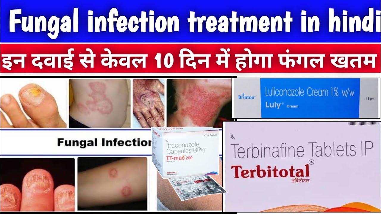 फंगल को जड़ से खत्म करेगी ये दवाई | fungal infection in private parts ...