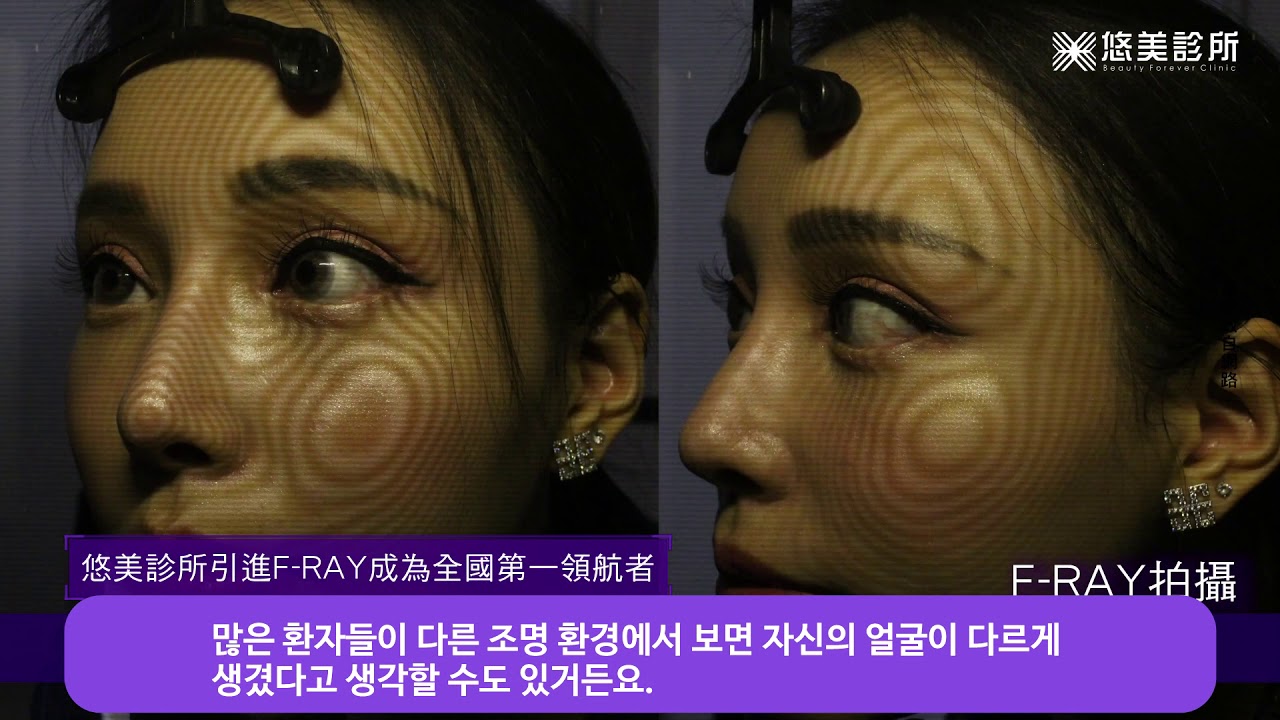F-RAY 미용시술 환자와의 훌륭한 소통 도구 / 대만 피부과 전문의 Dr. Nelson Chu 소개 - YouTube